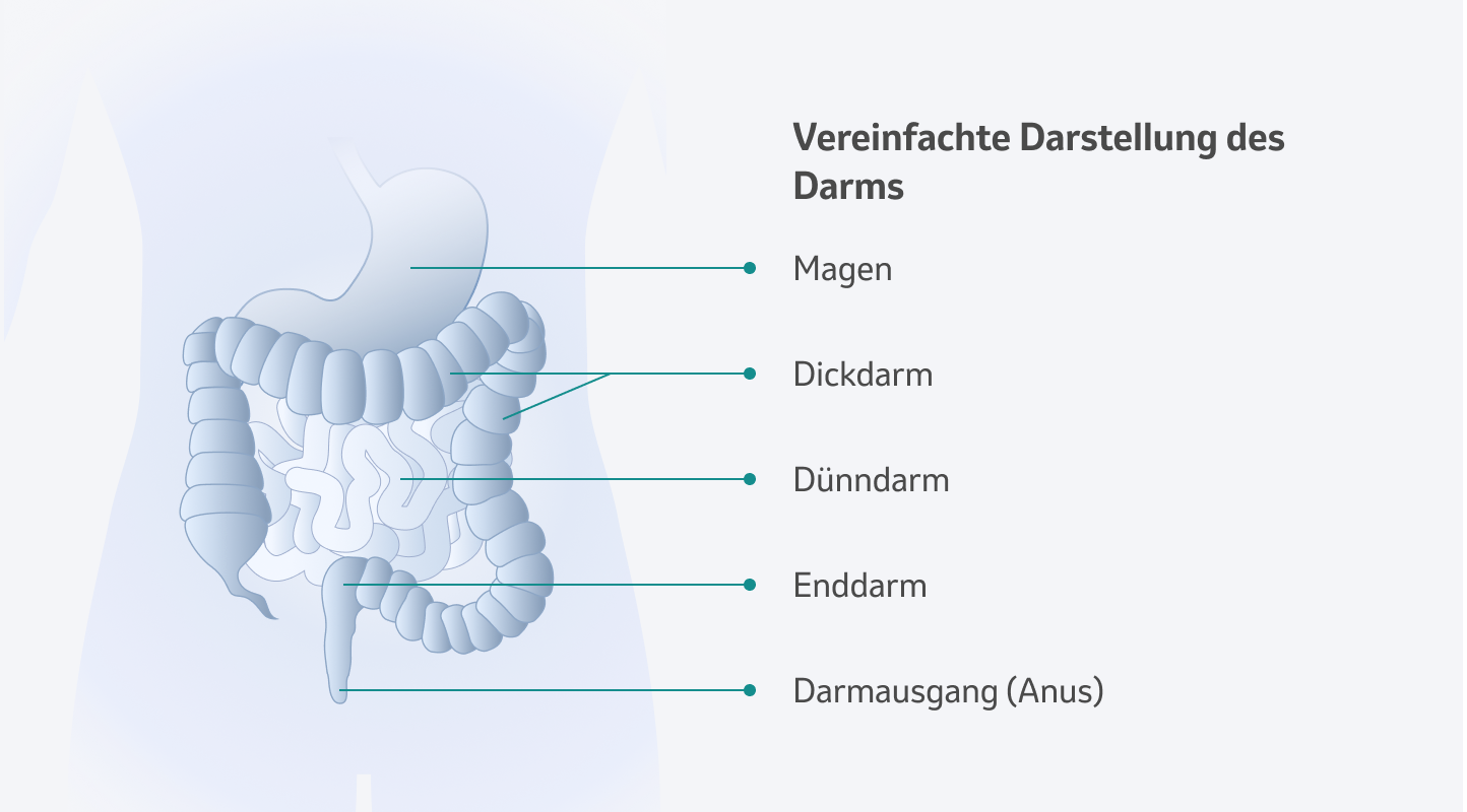 Colitis ulcerosa – Definition | MSD Gesundheit Schweiz